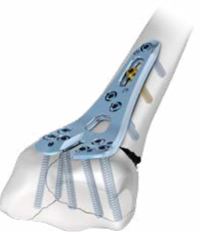 Aptus Radius - GPS-Ofa.cz